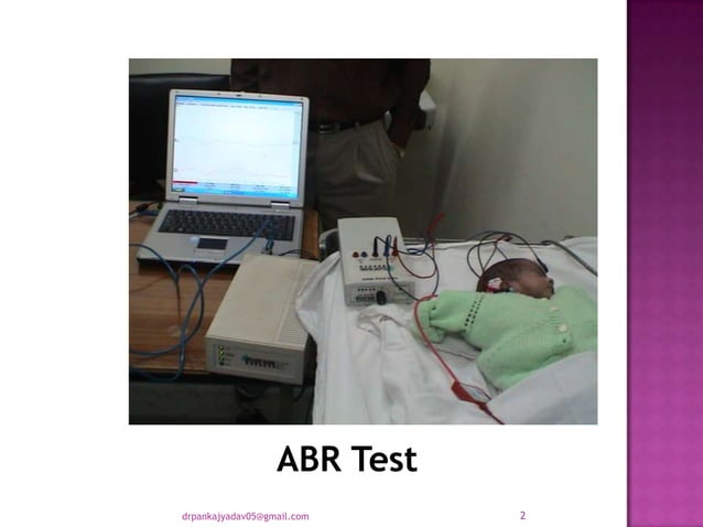 Auditory brainstem response (ABR) | PPTX | Digital Audio | Computer ...