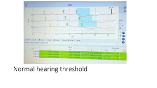 BERA.pptx | Free Download