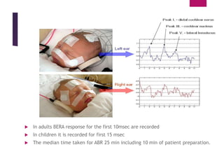 BERA- Dr. Richa Maurya | PPT