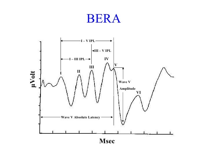 Generalidades de BERA