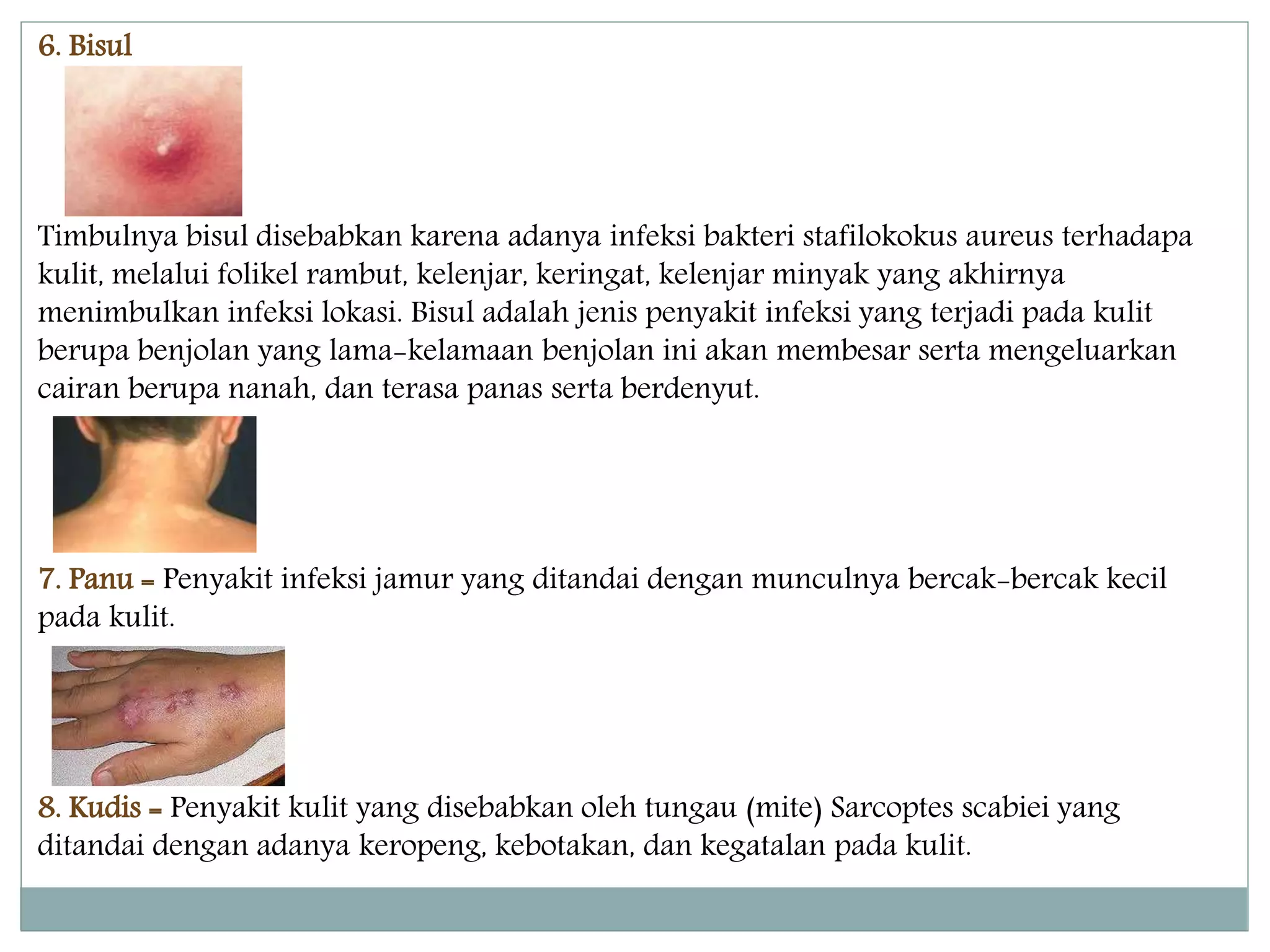 Berbagai jenis penyakit kulit dan obatnya | PPTX