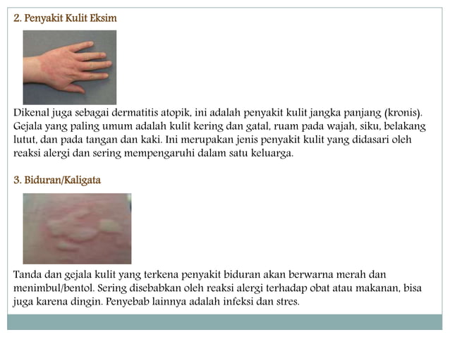 Berbagai jenis penyakit kulit dan obatnya | PPTX