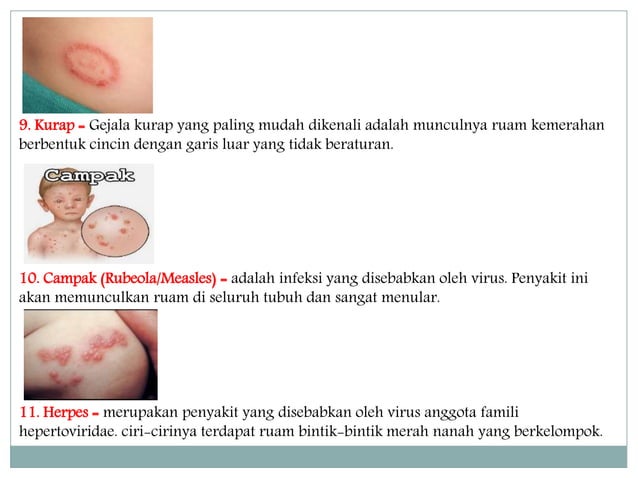 Berbagai jenis penyakit kulit dan obatnya | PPTX