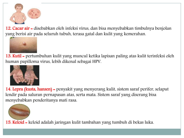 Berbagai jenis penyakit kulit dan obatnya | PPTX