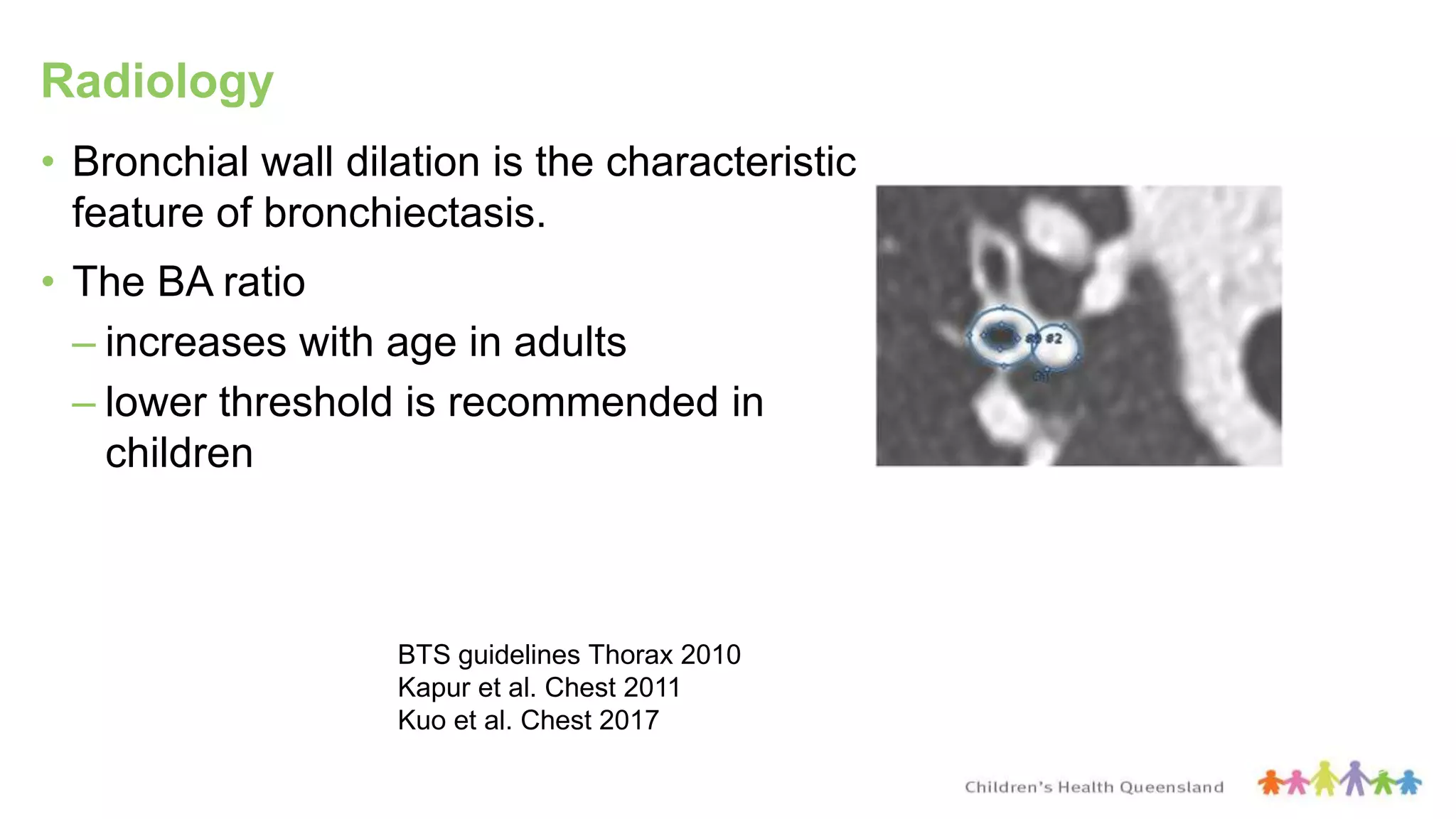 Bronchiectasis in children.ppt