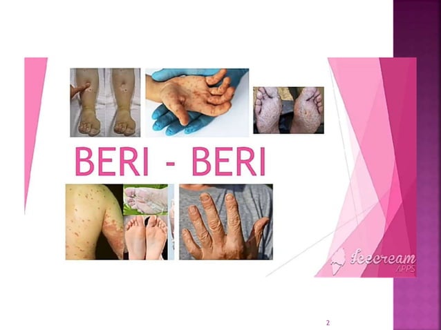 Beri beri | PPTX | Heart and Cardiovascular Diseases | Diseases and Conditions
