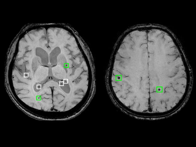 CONDOR: An automated framework to accelerate convolutional neural networks on FPGA | PDF