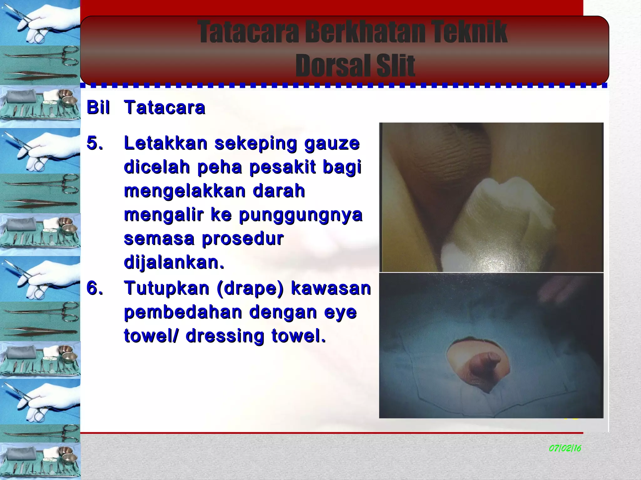 BERKHATAN (CIRCUMCISSION) | PPT