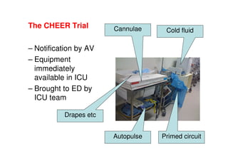BERNARD on ECMO CPR: It's ON | PPT