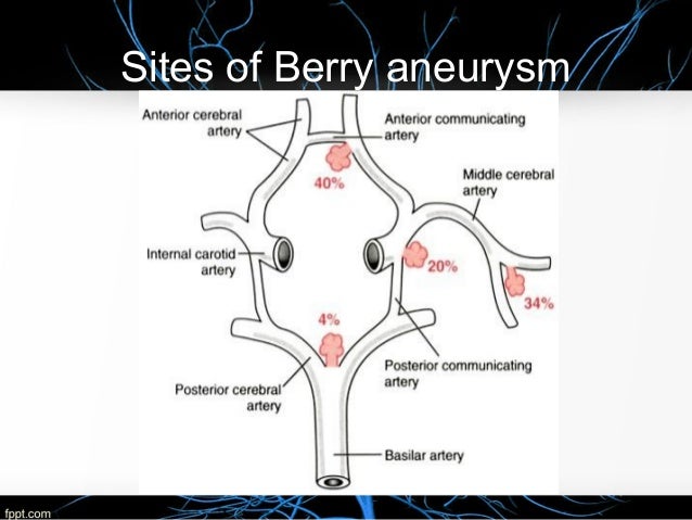 Berry aneurysm