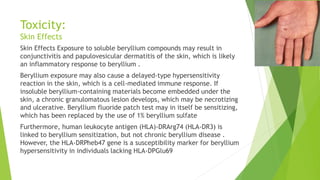Beryllium toxicity | PPTX