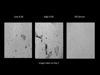 Biological Augmentation Of Rotator Cuff Tears | PPTX