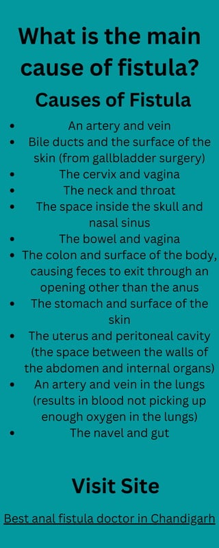 Best anal fistula doctor in Chandigarh | PDF