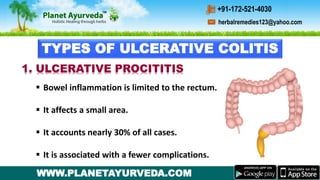 Best ayurvedic treatment of ulcerative colitis-Planet ayurveda | PPTX