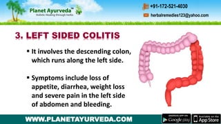 Best ayurvedic treatment of ulcerative colitis-Planet ayurveda | PPTX