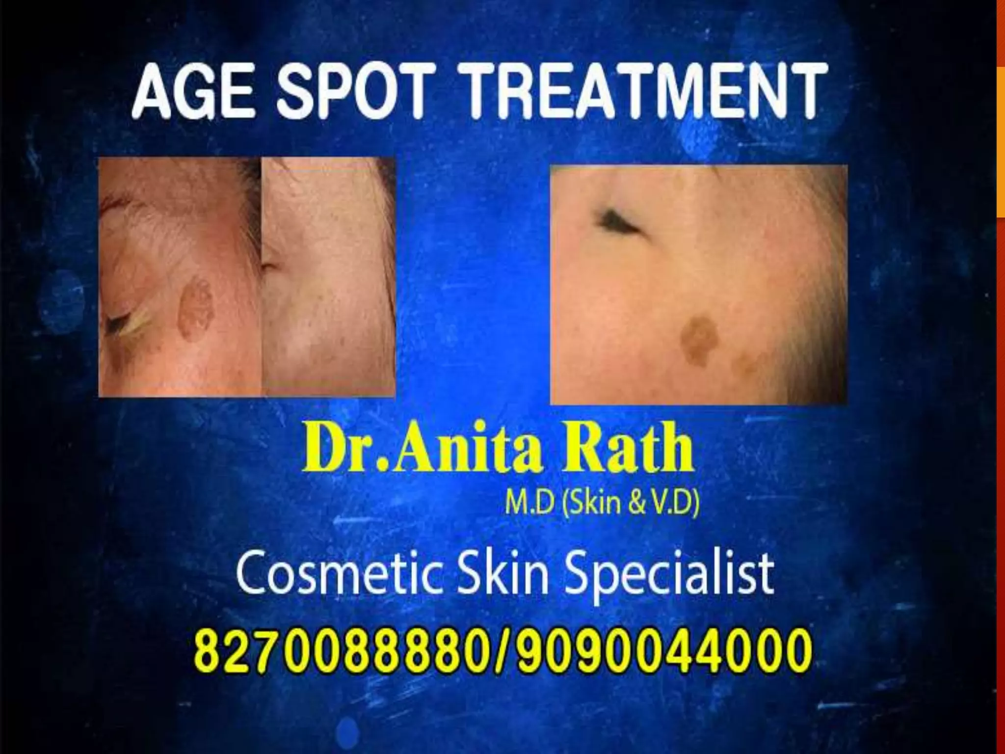 Best dermatologist & skin specialist in bhubaneswar dr anita rath | PPT