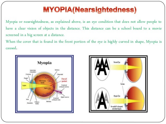 Best eye diseases treatment
