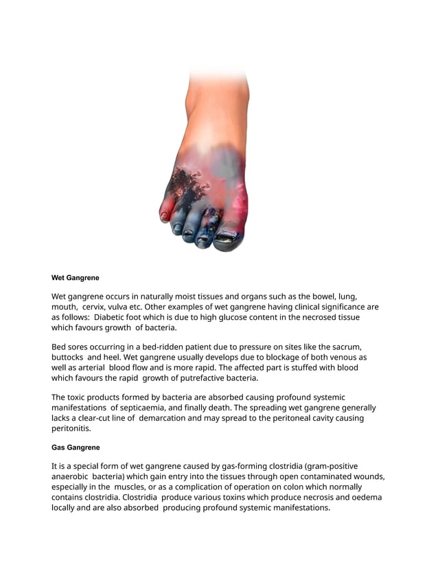 gangrene treatment in india KBK Hospital | PDF