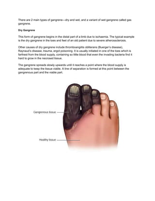 gangrene treatment without amputation KBK Hospitals | PDF