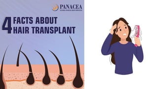 Best Hair Transplant in Delhi.pptx