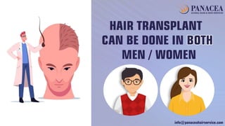 Best Hair Transplant in Delhi.pptx
