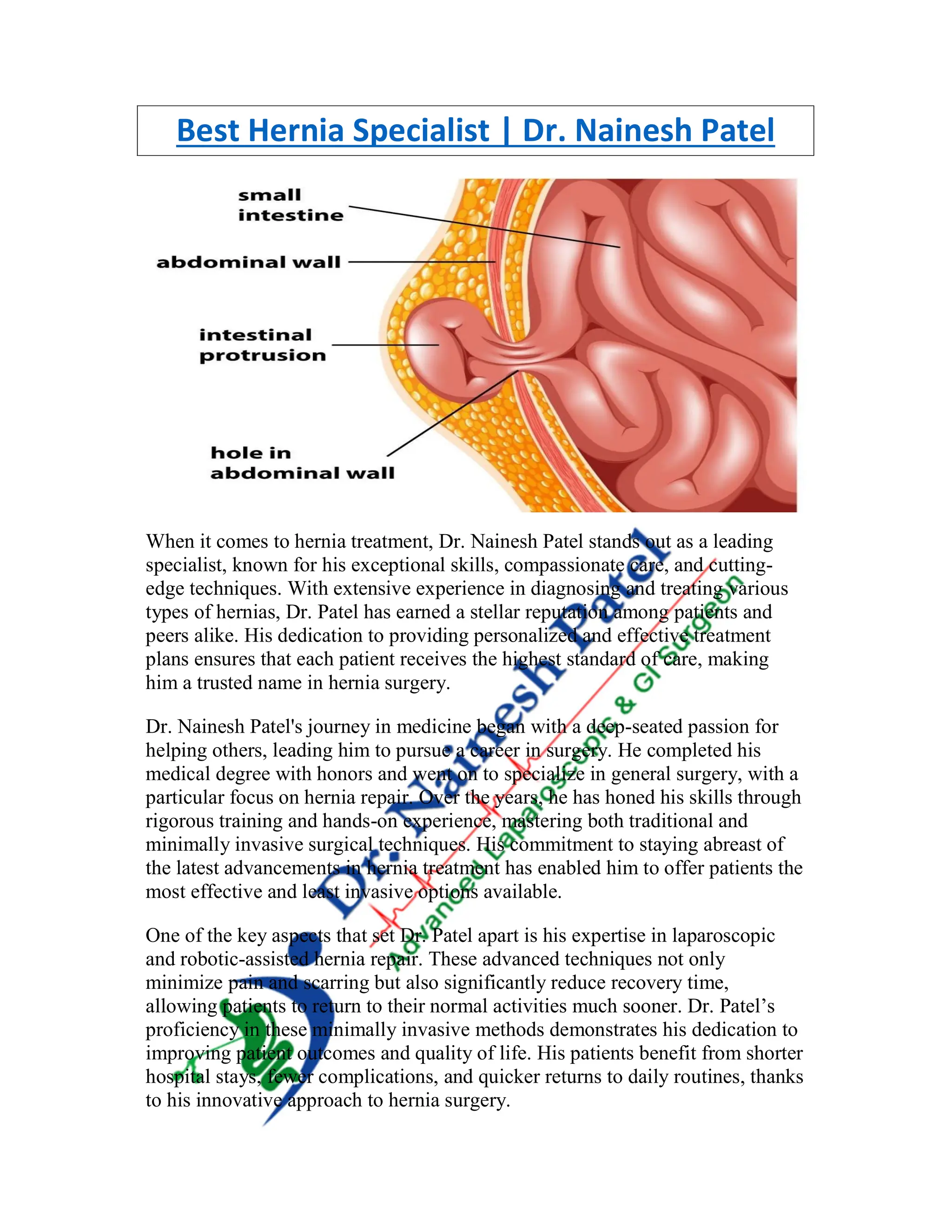 Best Hernia Specialist | Dr Nainesh Patel | PDF