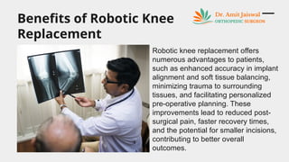 Best knee replacement surgeon in Varanasi.pptx