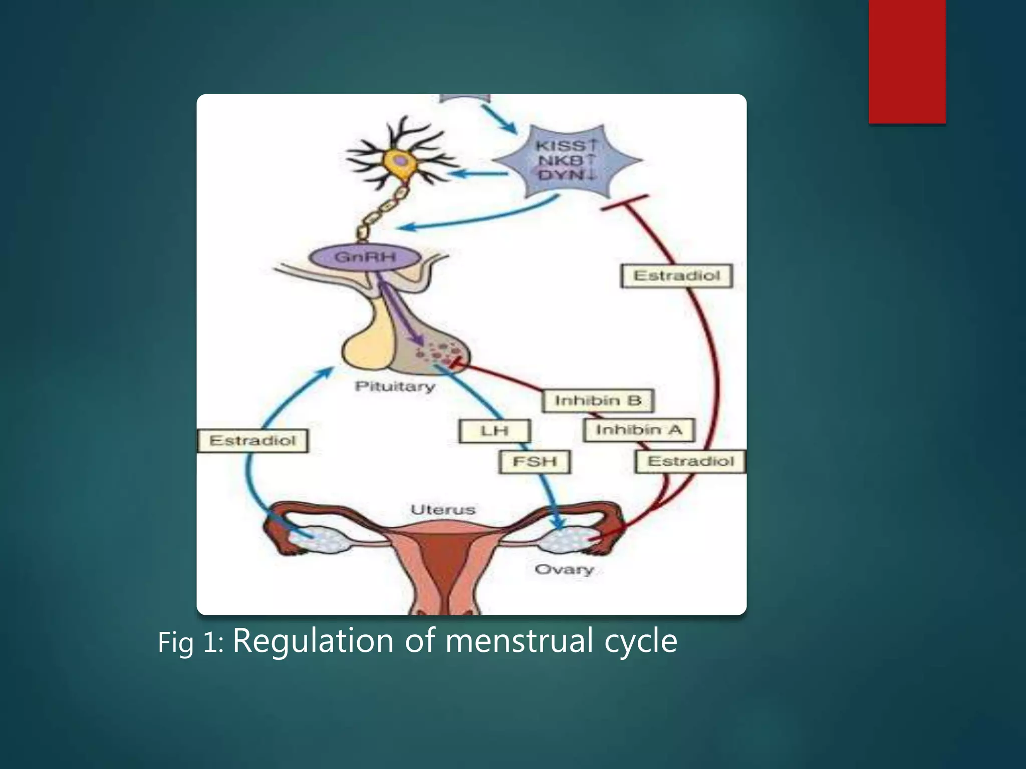 menstrual disorders.ppt
