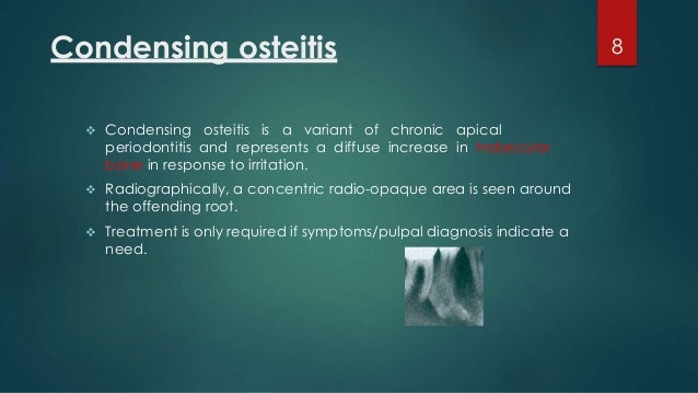 Best notes on classification of periapical disease