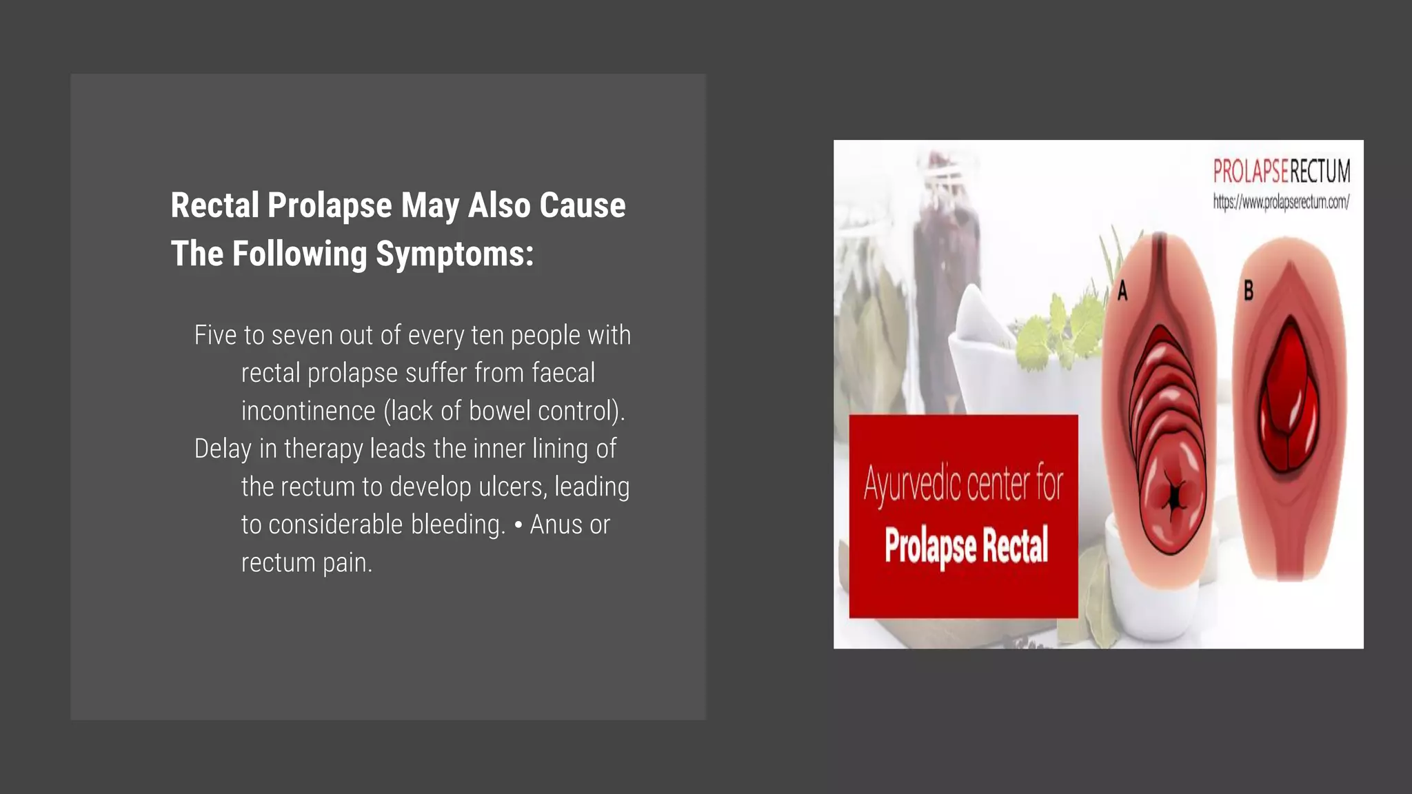 Best Rectal Prolapse Treatment | PPT