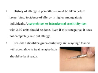 Beta lactam antibiotics - penicillins | PPTX