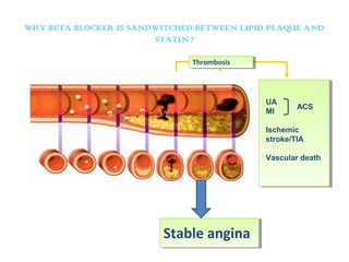 Betablocker in chronic stable angina 24-01-2013. | PPT