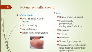 Beta lactam antibiotics (penicillins and cephalosporins) | PPTX