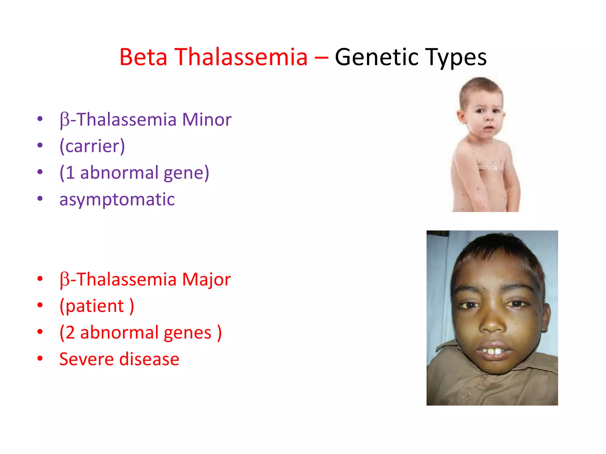 Beta thalassemia and thalassemia prevention 2021 | PDF