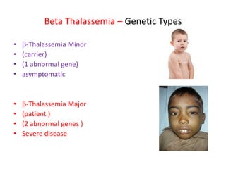 Beta thalassemia and thalassemia prevention 2021 | PPT