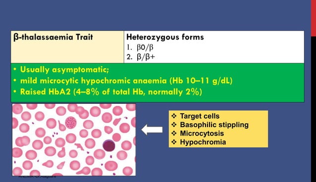 Beta Thalassemia Syndromes Ppt