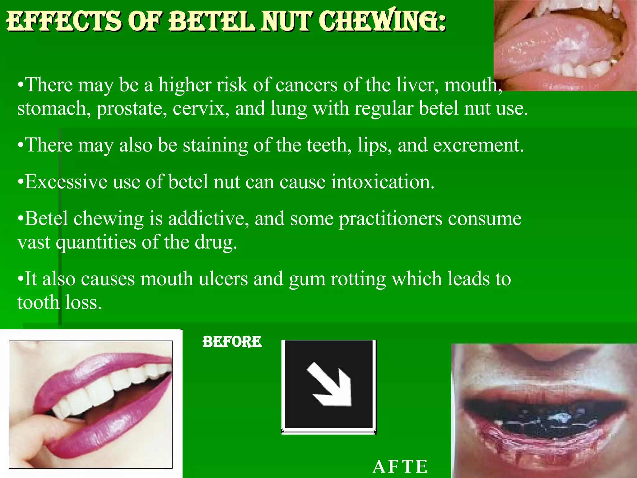Betel Nut | PPT