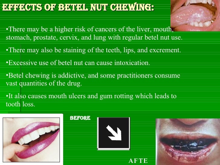 Betel Nut