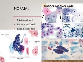 Glandular Endocervical Cells