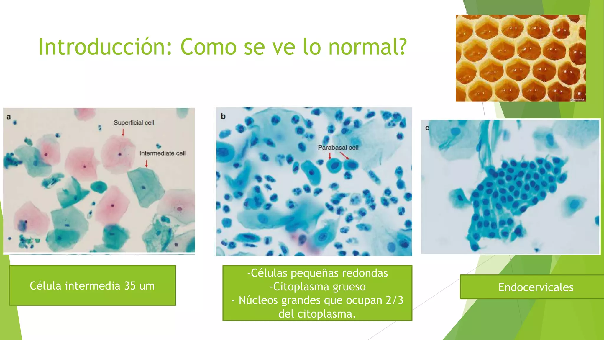 Anormalidades en la citologia | PPTX