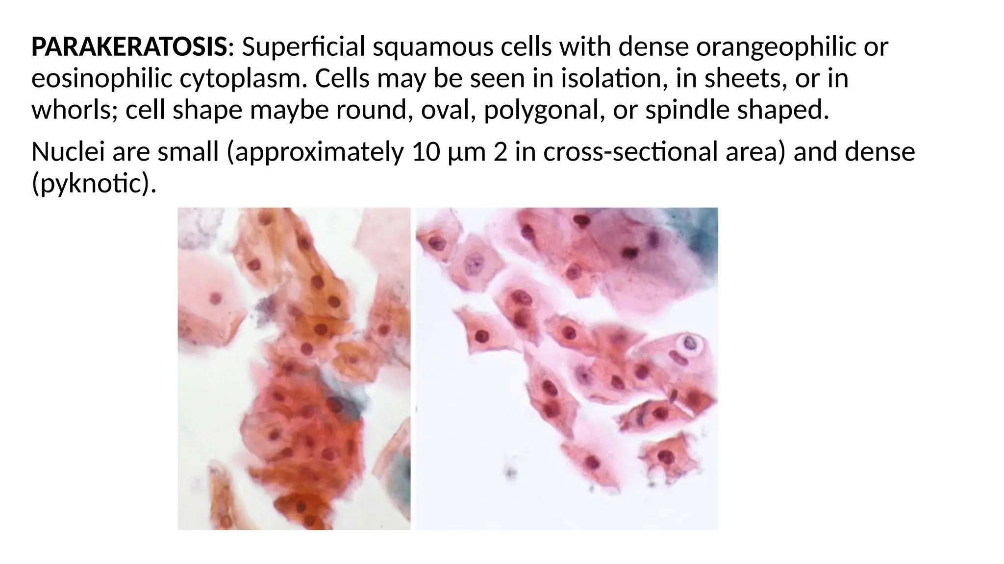 Bethesda Classification of Cervical Cytology-MANYA YADAV (1) (1).pptx