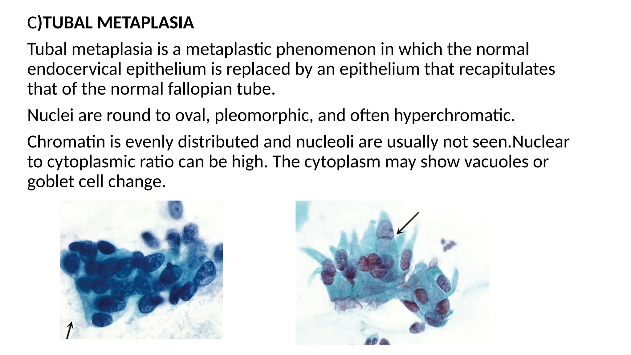 Bethesda Classification of Cervical Cytology-MANYA YADAV (1) (1).pptx
