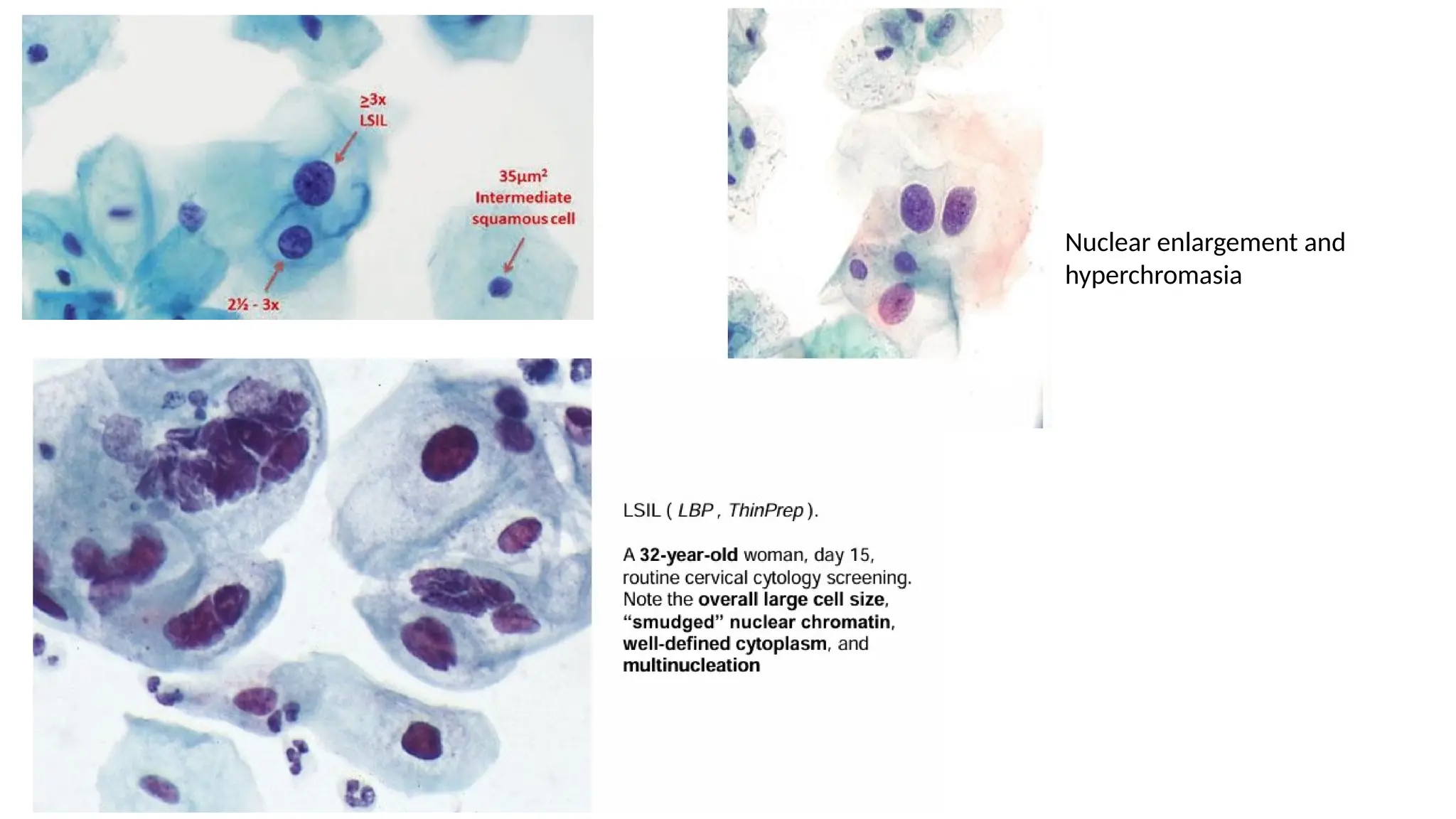 Bethesda Classification of Cervical Cytology-MANYA YADAV (1) (1).pptx