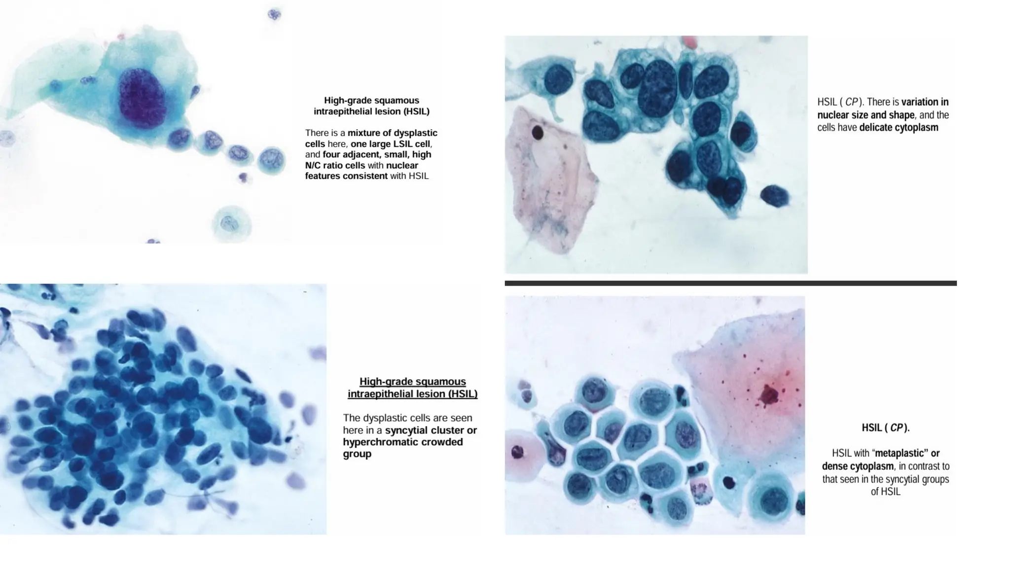 Bethesda Classification of Cervical Cytology-MANYA YADAV (1) (1).pptx