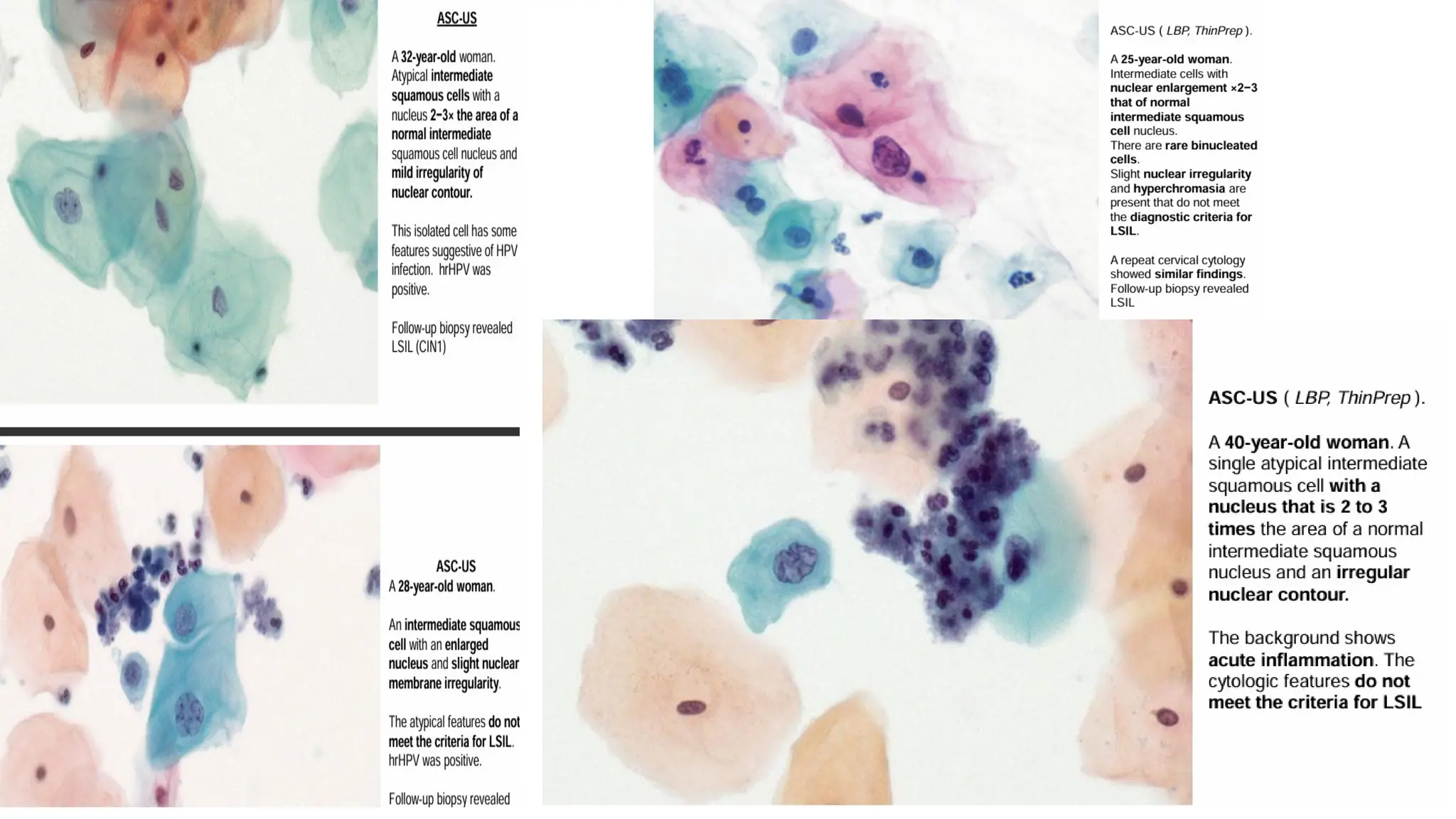 Bethesda Classification of Cervical Cytology-MANYA YADAV (1) (1).pptx