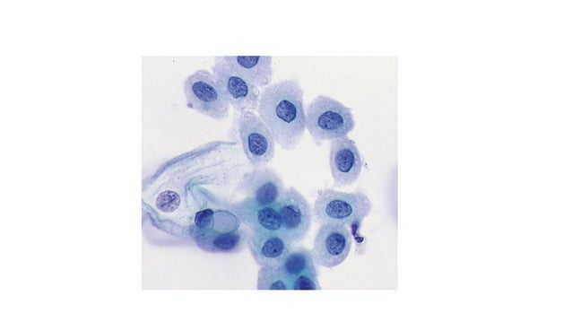 Bethesda Classification of Cervical Cytology-MANYA YADAV (1) (1).pptx