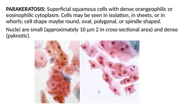 Bethesda Classification of Cervical Cytology-MANYA YADAV (1) (1).pptx