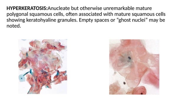 Bethesda Classification of Cervical Cytology-MANYA YADAV (1) (1).pptx