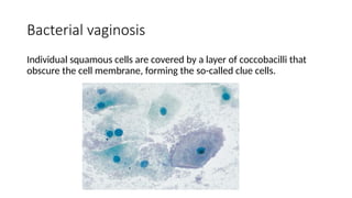 Bethesda Classification of Cervical Cytology-MANYA YADAV (1) (1).pptx