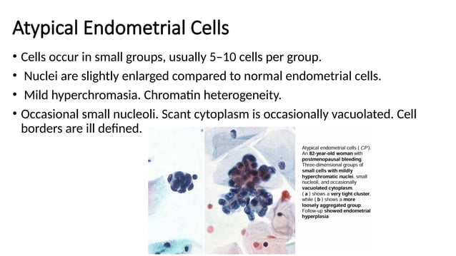 Bethesda Classification of Cervical Cytology-MANYA YADAV (1) (1).pptx
